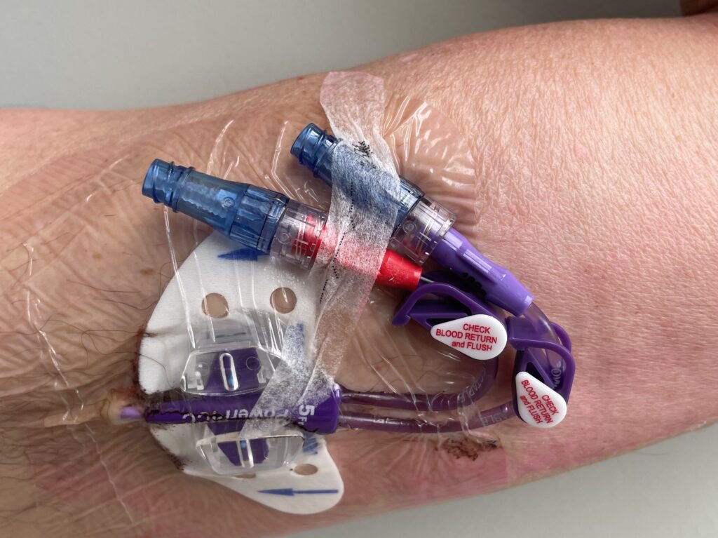 Draaideur – Fietsen met Frank